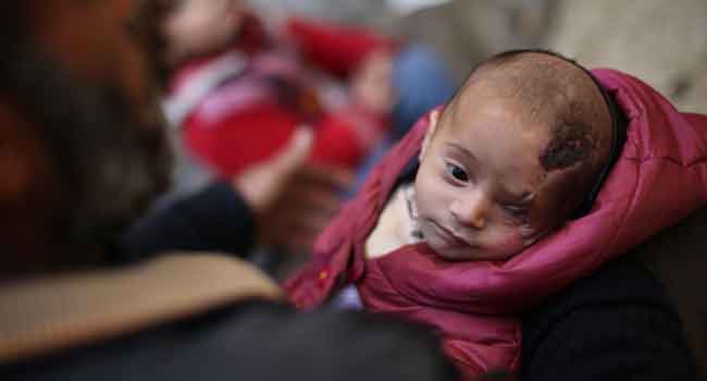 Blinded In One Eye, Syrian Baby Becomes Symbol Of Siege – Channels ...