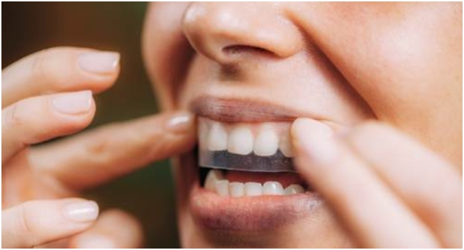 Beware Teeth-Fixing Products Touted By Influencers, Dentists Warn